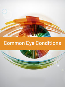 Home » Louisiana Center For Eyes